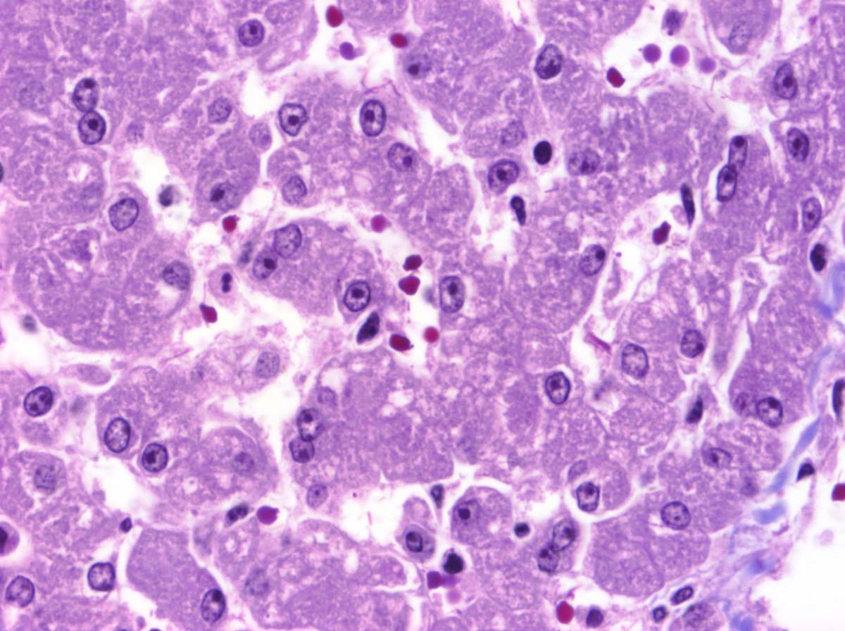 Células de Kupffer - Tipos de Celulas