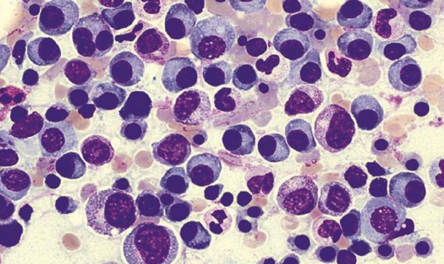 Células T - Tipos de Celulas