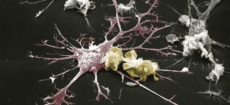 Células dendríticas - Tipos de Celulas